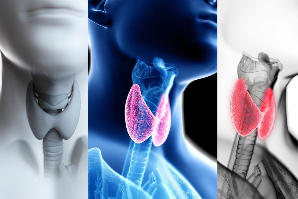 7 Compelling Reasons To Choose Thyroidectomy For Graves Disease
